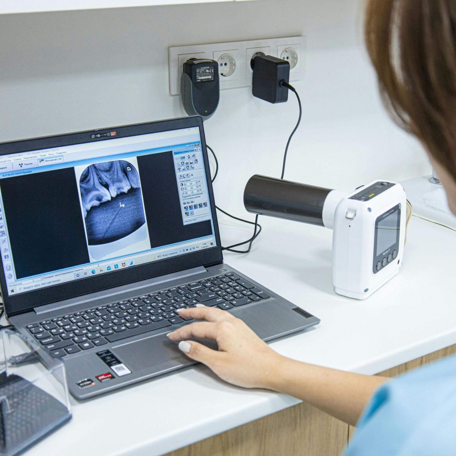 3 Common Dental X-Ray Errors (And How Tarsier X Helps You Avoid Them ...